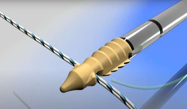 Sports Medicine Polymer Solutions | PEEK-OPTIMA - Invibio